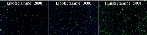 Transfection Reagents Aat Bioquest
