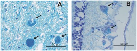 Luxol Fast Blue Lfb Staining Of The A Cerebrum And B Retina From Download Scientific
