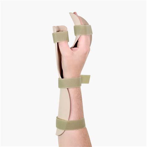 Kydex Cock Up Splint Orthomerica Beagle Orthopaedic