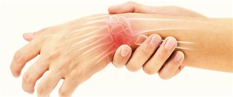 손목터널증후군 손발 관절센터 S 서울병원