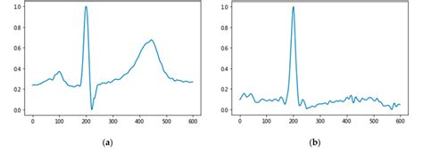 Figure 4 From Myocardial Infarction Classification Based On