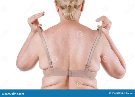 Obesity Female Body Fat Woman Back Isolated On White Background Stock