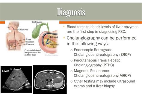 Ppt Primary Sclerosing Cholangitis Psc Powerpoint Presentation