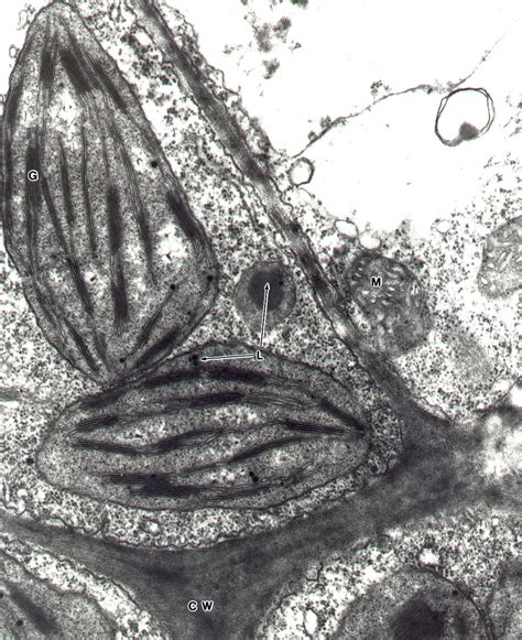 Chloroplast Micrograph