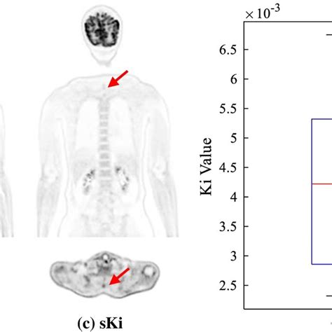 An Example Of Generated Total Body Parametric Download Scientific Diagram