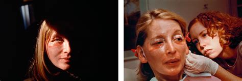 Plastic Surgery What Happens Between Before And After