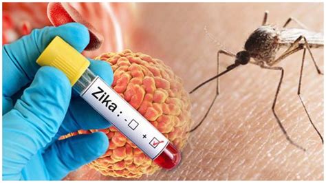 क्या है Zika Virus जानें कारण और लक्षण Zika Virus Causes Symptoms In