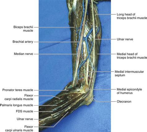Ulnar Nerve Neupsy Key