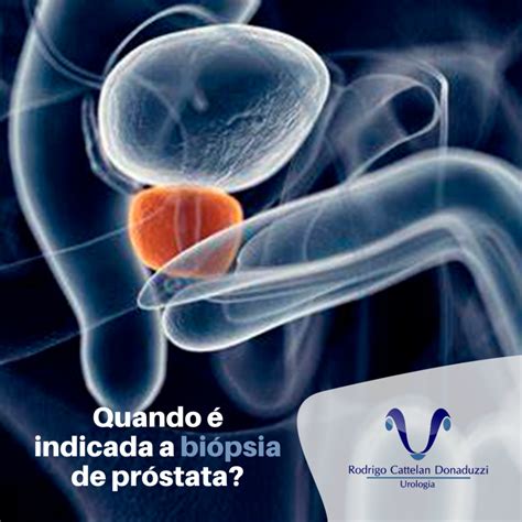 Criptorquidia Sintomas Rodrigo Donaduzzi