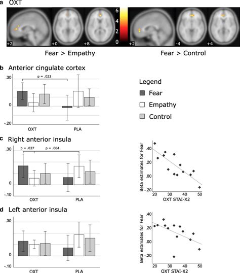Voxel Wise Whole Brain Analysis A With Higher Acc Activation In The