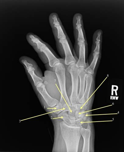 Film Id Flashcards Quizlet