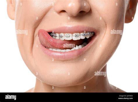 Girl Braces Tongue Hi Res Stock Photography And Images Alamy