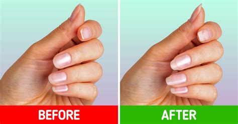 7 Useful Tips For How To Grow Your Nails Faster And Healthier 5