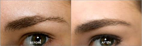Permanent Makeup Ct Proskin Clinics