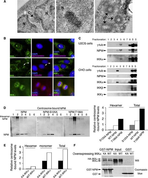 S125 Of Npm Regulates Centrosome Bound Npm Levels A Left