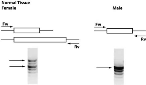 Methylation Specific Pcrhuman Androgen Receptor Gene Humara Assay