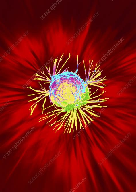 Coloured Sem Of A Breast Cancer Cell Stock Image M1220208