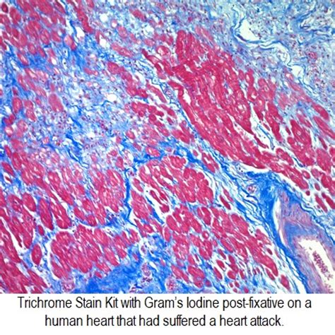 Trichrome Histology Stain Kit With Iodine