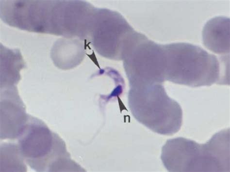 Parasitology Final Flashcards Quizlet