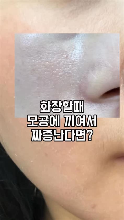 인천 동안술사 리우에스테틱 대표원장 육예선 기미 부자들 주목하세요 ⚠️ 👉🏻기분좋은 기미 거지 만들어드릴게요 기미 주근깨 많은 친구들에게 공유해주세요 📤 어릴때부터
