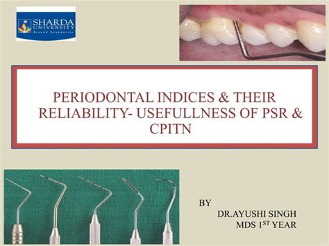 Periodontal Indices Ppt