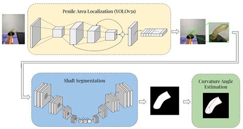 Frontiers Automated Quantification Of Penile Curvature Using Artificial Intelligence