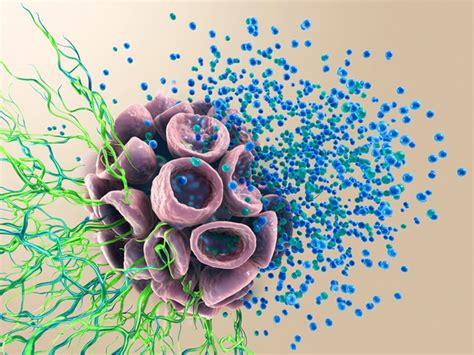 胶质母细胞瘤的医学专业名称是什么 胶质母细胞瘤 胶质瘤 肿瘤疾病大全 癌症肿瘤科普知识 有来医生