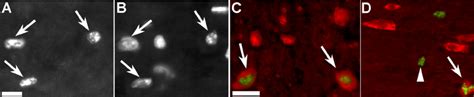 Tunel Labeling Of Apoptotic Nuclei Adjacent To The Spinal Cord Download Scientific Diagram