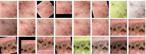 tensorflow实现深度学习案例4：猴痘病识别 tensorflow 图片识别病例 csdn博客