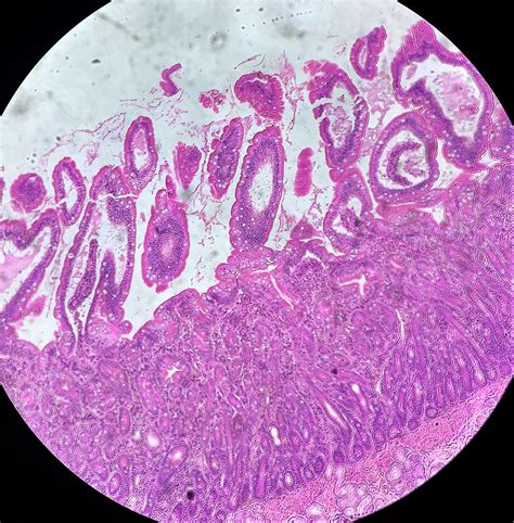 Duodenum 100x Diagram Quizlet