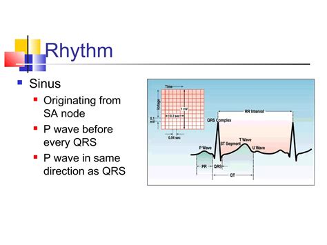 Ecg Interpretation Ppt
