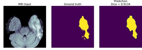 GitHub Blackbird71SR Brain Segmentation And Tumor Detection Modified