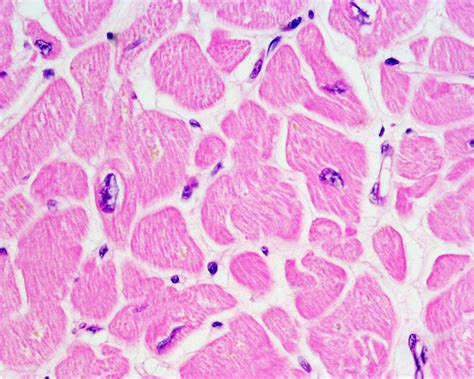 Cardiac Muscle Fiber Histology