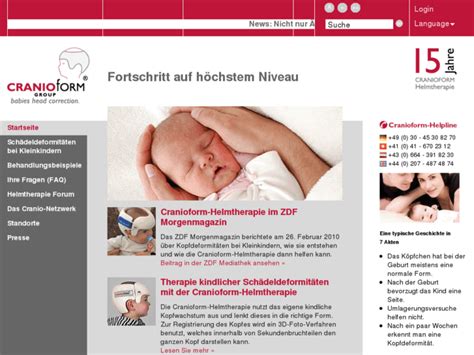 Cranioformde Fortschritt Auf Höchstem Niveau Helmtherapie Mit