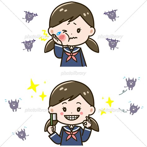 【50】 虫歯 予防 イラスト ~ 無料の印刷可能なイラスト画像