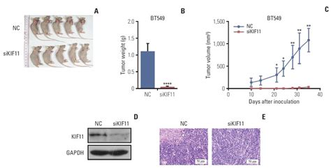 Kif11 Functions As An Oncogene And Is Associated With Poor Outcomes From Breast Cancer Pmc