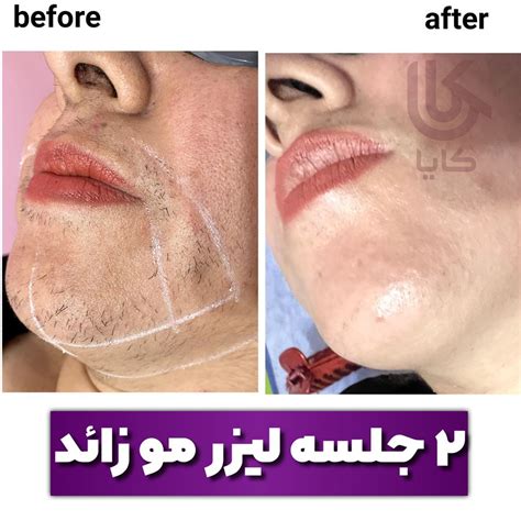 کلینیک پوست، مو و زیبایی کایا