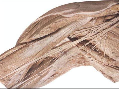 Brachial Plexus Anatomy And Clinical Implications