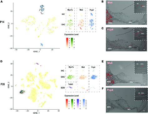 The Expression Pattern Of Newly Identified Hc And Sgn Marker Gene Miat
