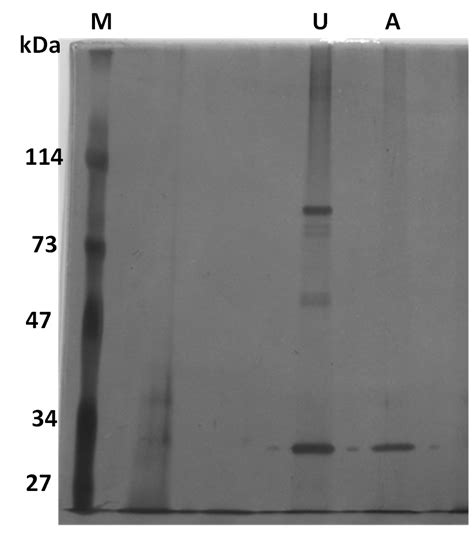 Parasporins Of Bacillus Thuringiensis Strain Exhibit Apoptosis Mediated