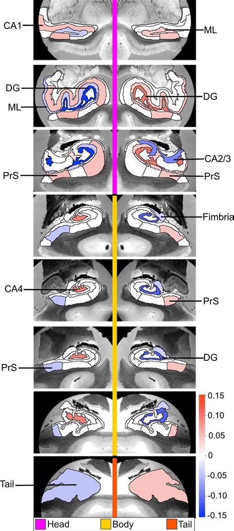 specific hippocampus subfields are differentially affected by solitary download scientific