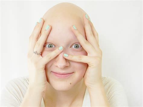The Beautiful Bald Chick December 2011