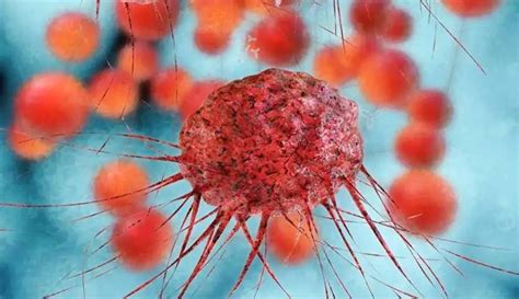 علاج واعد لأحد أخطر أنواع سرطان الدم أخبار السعودية صحيفة عكاظ