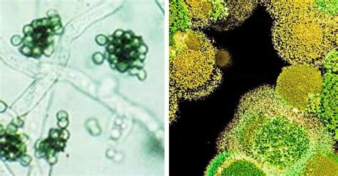 कृषि और बागवानी में ट्राइकोडर्मा के चमत्कारिक फायदे