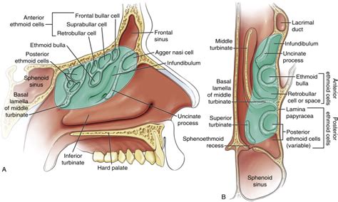 Partial And Complete Ethmoidectomy Ento Key