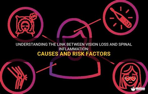 Understanding The Link Between Vision Loss And Spinal Inflammation