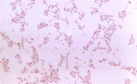 Jorge Zambrano Ph D On Linkedin Vitamin D Boosts Gut Bacteria
