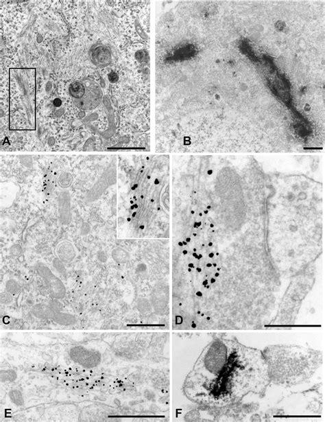 Exogenous α Synuclein Fibrils Induce Lewy Body Pathology Leading To