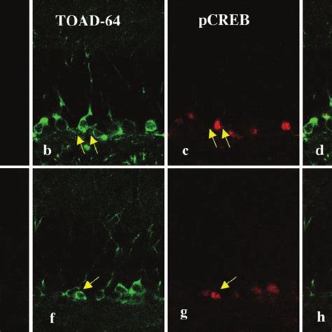 Colocalization Of Creb Or Pcreb And Psa Ncam In The Developing Download Scientific Diagram