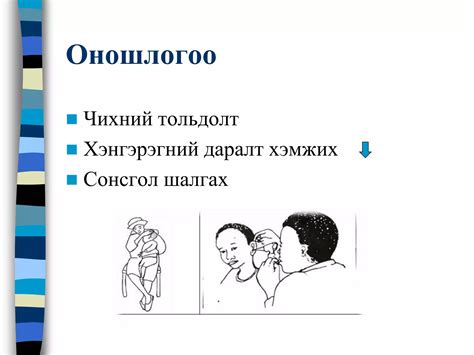 Дунд чихний архаг үрэвсэл Pptx